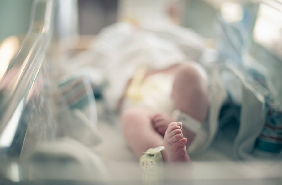 Este bebé con defectos extremadamente raros ha nacido con un solo ojo ...